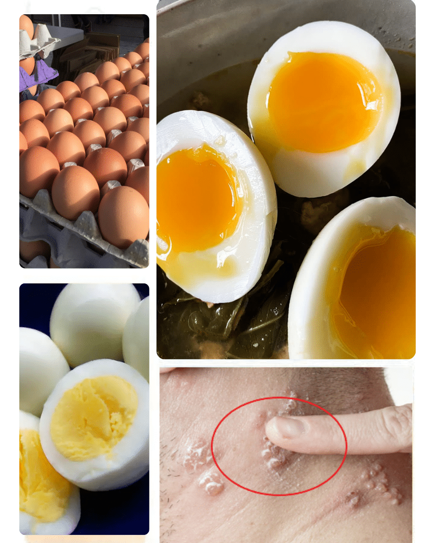 Daily Egg Consumption: How It Impacts Your Body – The Surprising ...